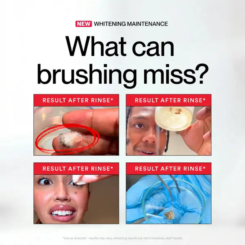 Hismile Id Stain Whitening Mouthwash for White Teeth, Freshens Breath ...